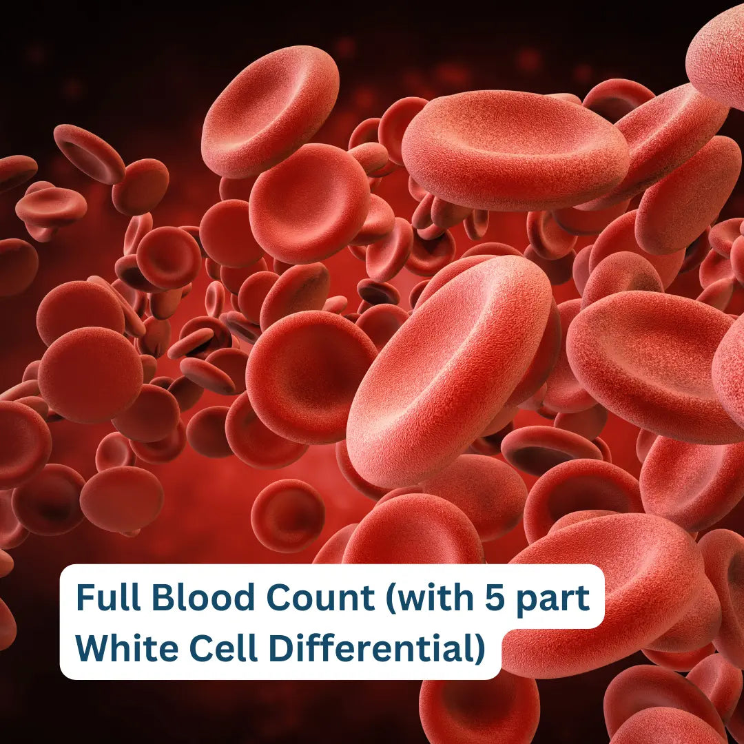 Full Blood Count Blood Test (FBC/CBC)| Next Day Results – Epsom Blood Tests